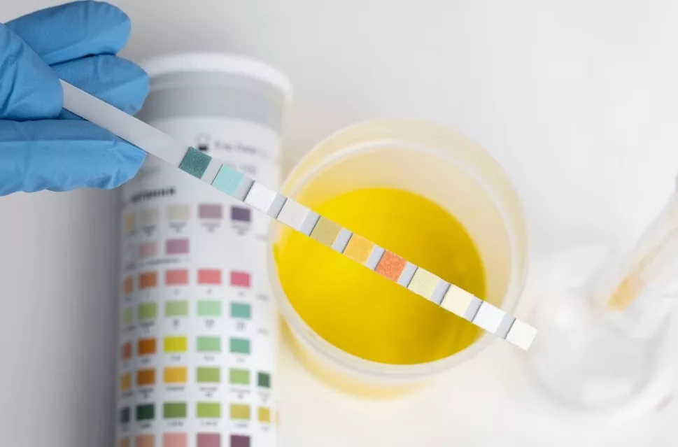 Nanoparticle Sensors to Detect Cancer Markers in Urine for Early ...